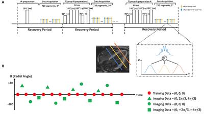 Frontiers | Simultaneous Multi-Slice Cardiac MR Multitasking for Motion-Resolved, Non-ECG, Free ...